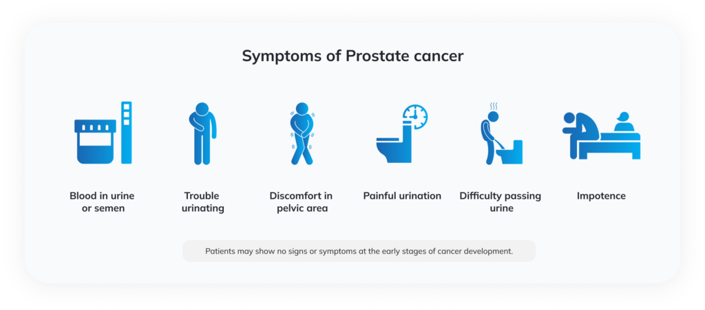 About prostate cancer - Diagnolita
