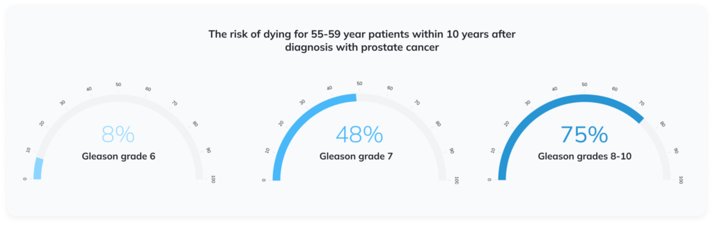 About prostate cancer - Diagnolita